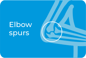 Shoulder and Elbow Care - Campbell Clinic Orthopaedics