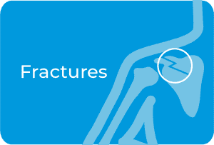 Shoulder and Elbow Care - Campbell Clinic Orthopaedics